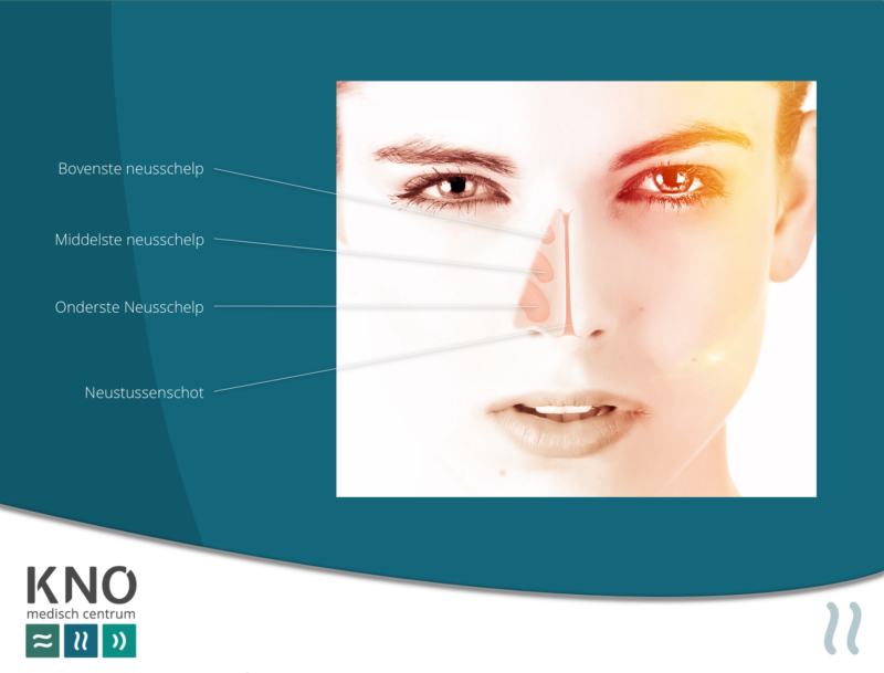 Scabs in the nose - KNO MEDISCH CENTRUM