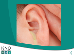 loopoor met klachten - KNO MEDISCH CENTRUM